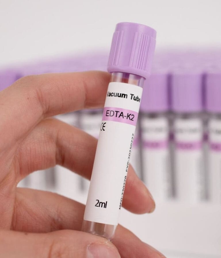 EDTA Tubes – High-Quality Blood Collection Tubes Manufacturer